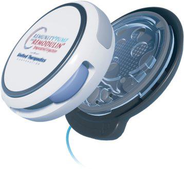 Remodulin (treprostinil) Pump Options