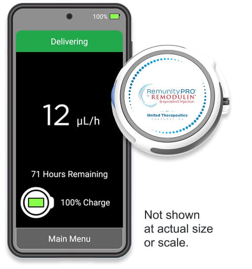 Remodulin (treprostinil) Pump Options